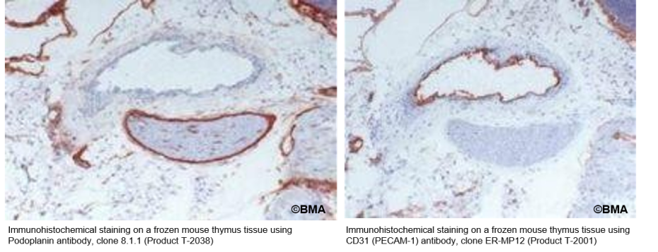 Identification Of Lymphatic And Blood Vessels - BMA