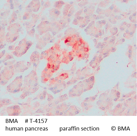 Antibody: T-4157, Amylin (25-37), purified IgG.